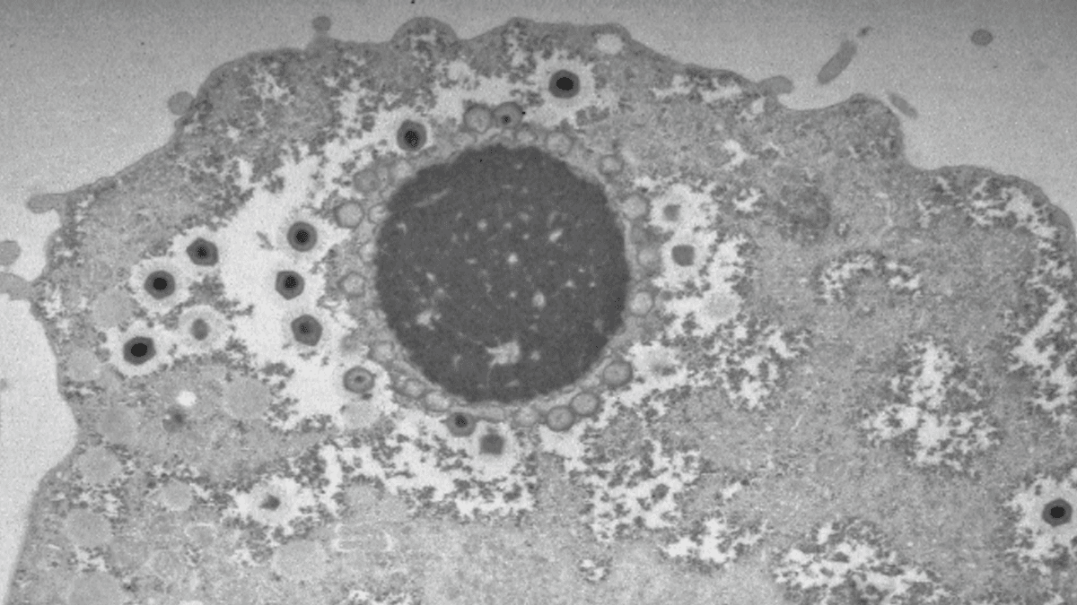 A newly discovered giant virus has a unique way of hijacking its host ...