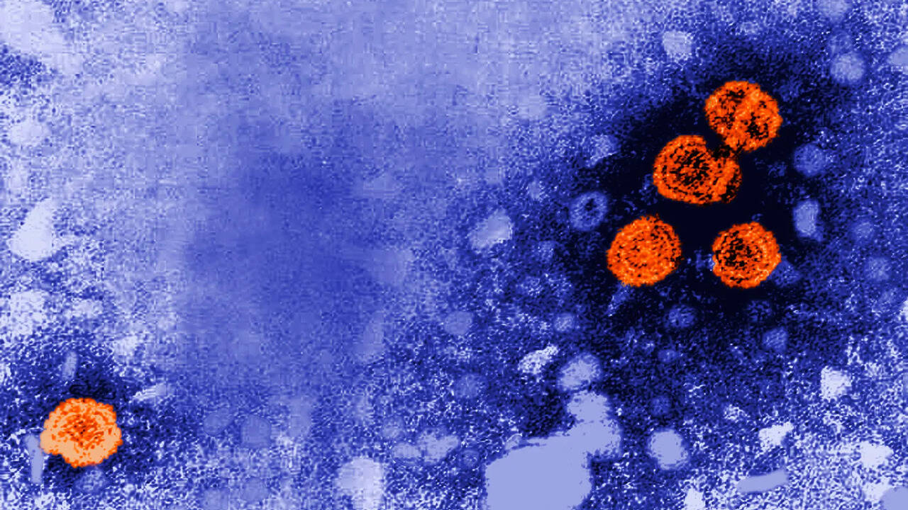 New hepatitis B drug shows promise for functional cure in patients