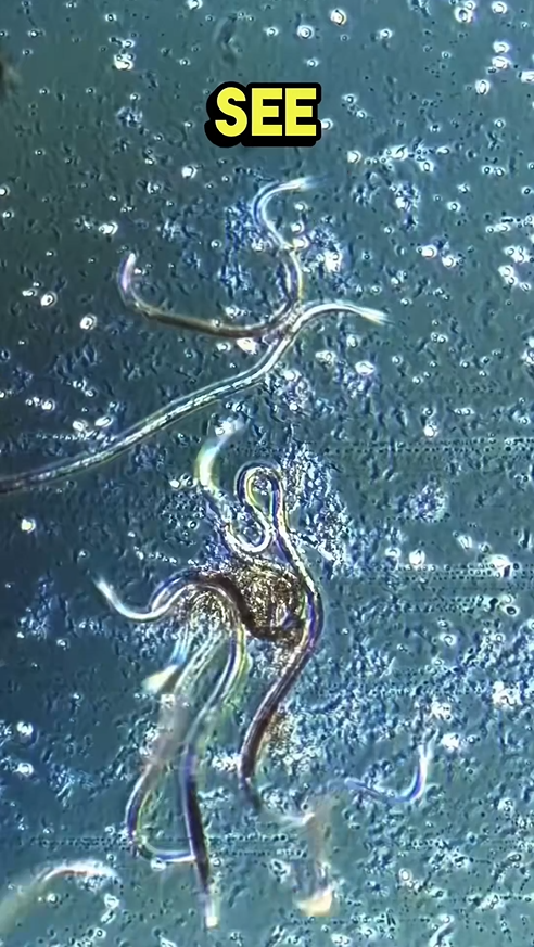 Parasites under the microscope vs ivermectin