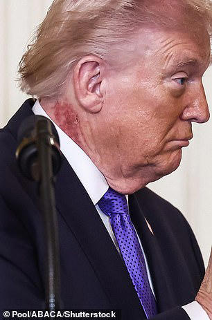 Trump's delayed physical results raise eyebrows amid worries about his ...