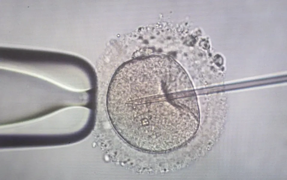 Experts dispel myths on IVF children's long-term health