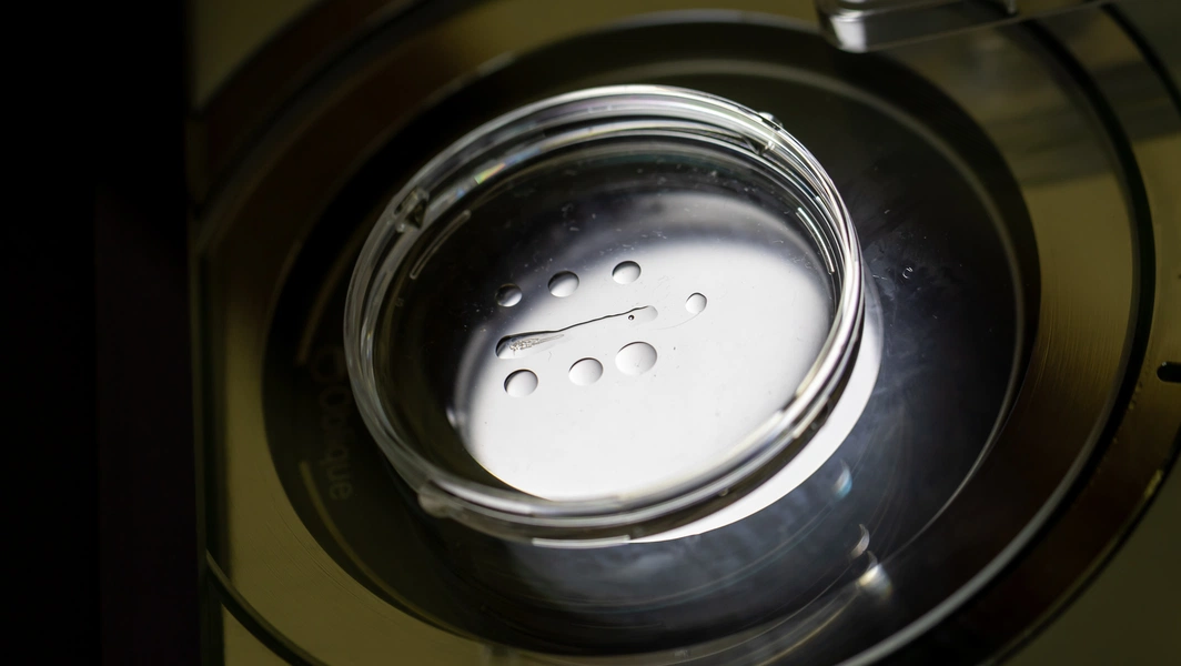 Experts dispel myths on IVF children's long-term health