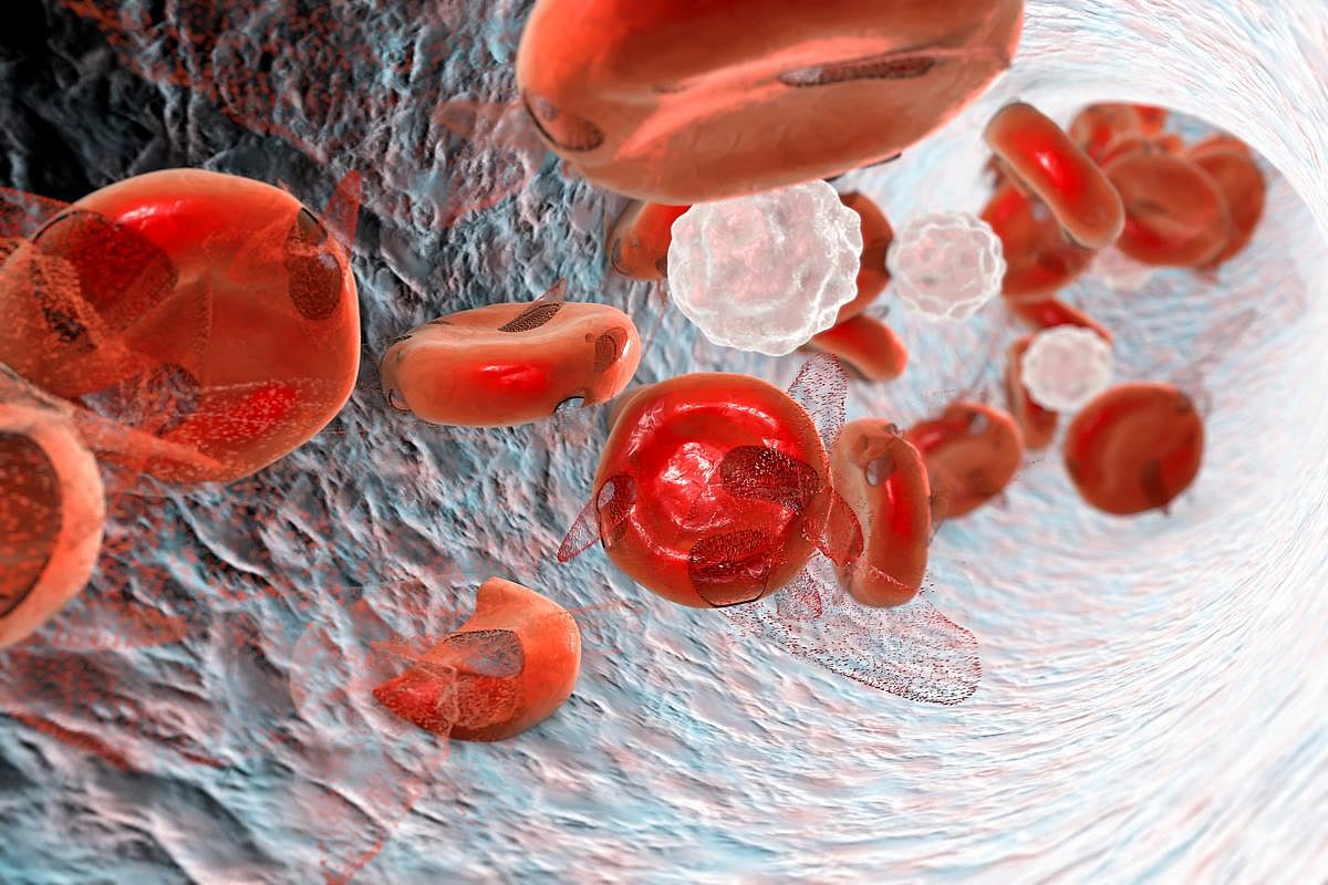 Physiologically based ferritin thresholds for iron deficiency ID'd for ...