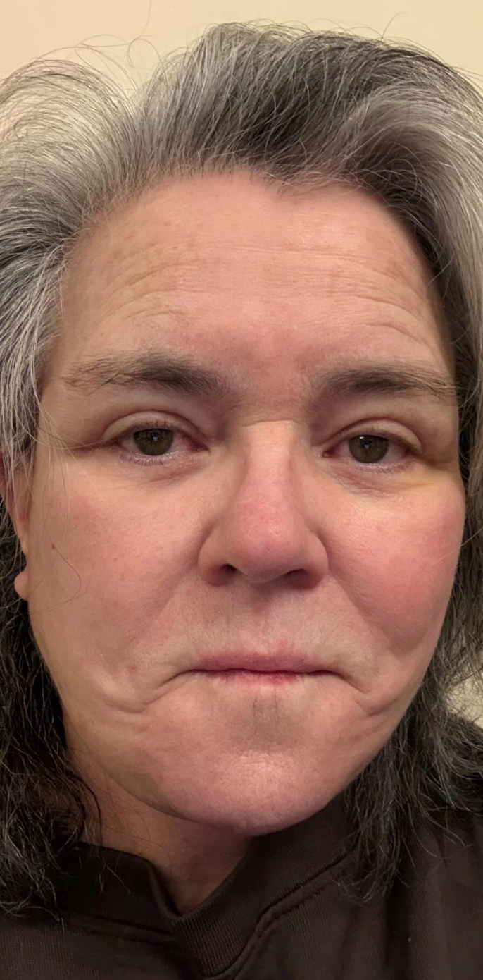 Rosie O’Donnell showed the results of her secret facelift