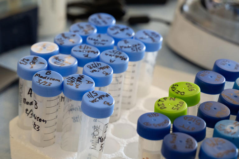 The World Cup is a petri dish