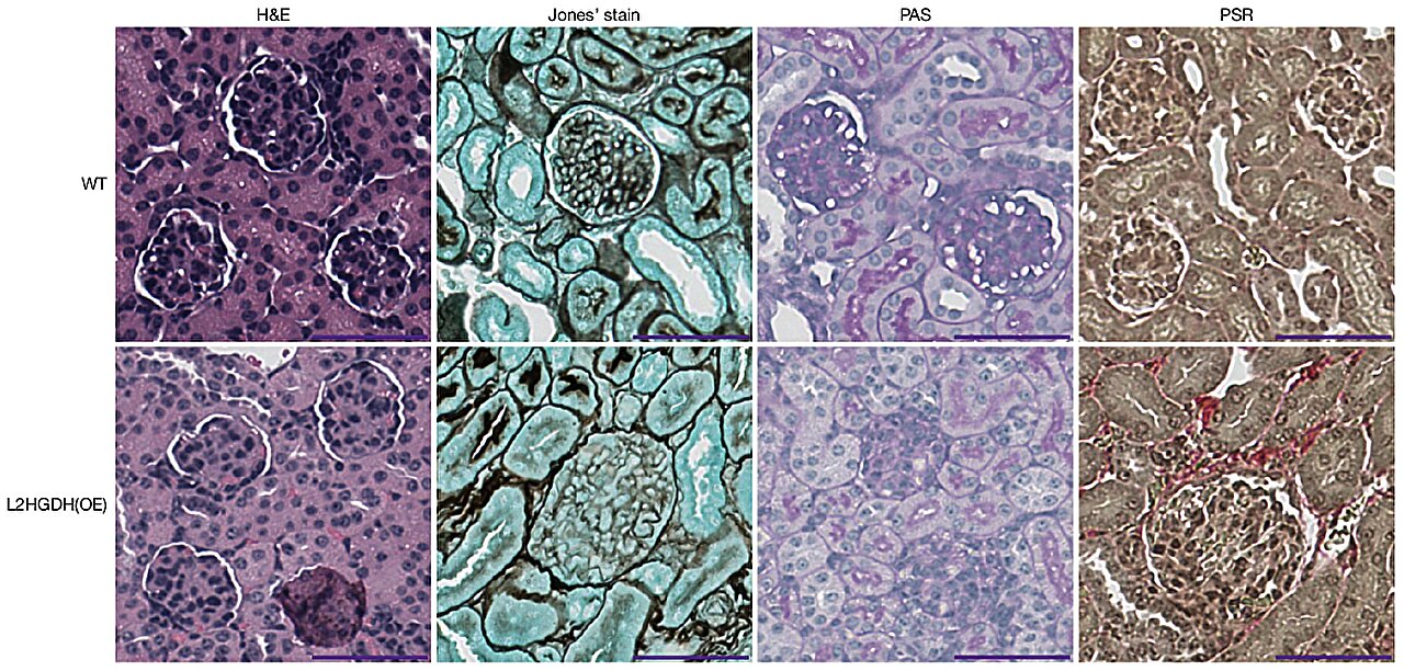'Toxic' molecule may play vital role in gene regulation and development