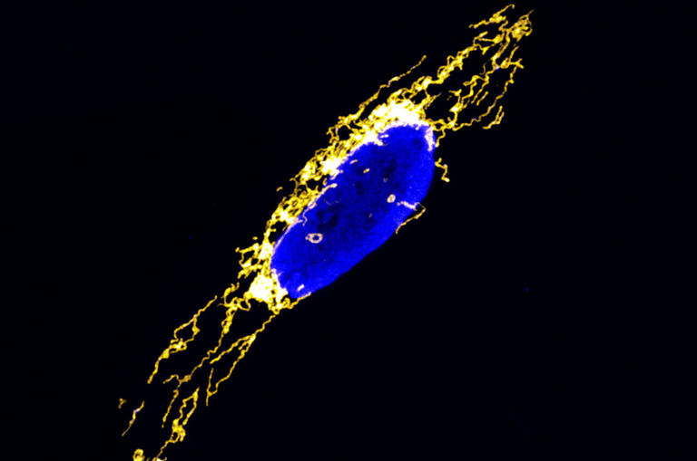 Mitochondria reveal built-in speed control for protein production