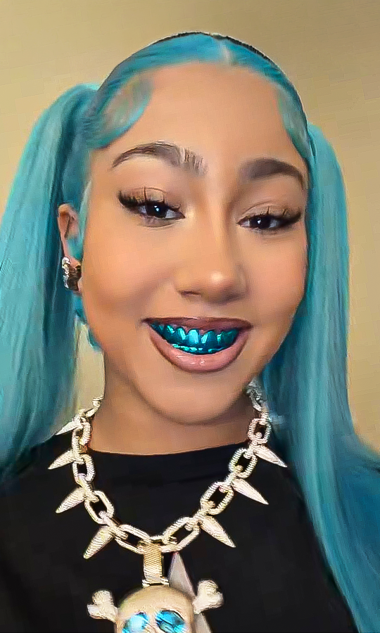 North West gets new teeth 🚨