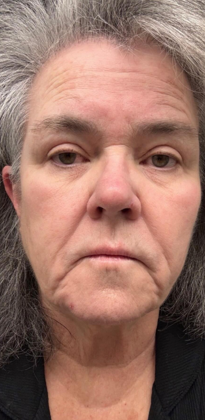 Rosie O’Donnell showed the results of her secret facelift