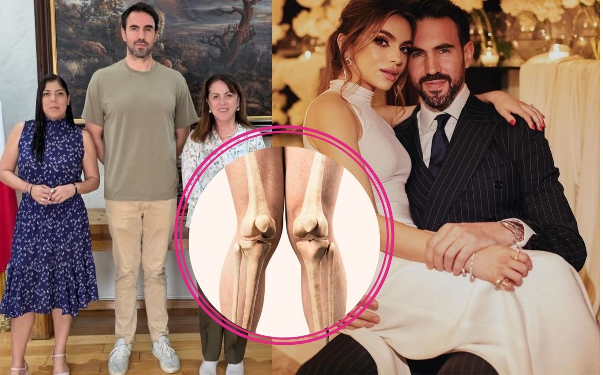 Rodillas de Pablo Bernot, esposo de Sofía Castro, desatan indicios de ...