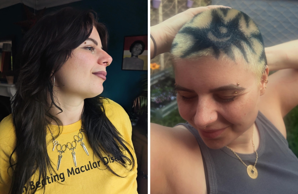 Student’s head shave party after sight loss diagnosis