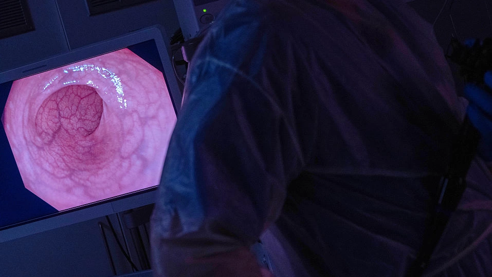 Blood test joins colon cancer screening options amid rising cases