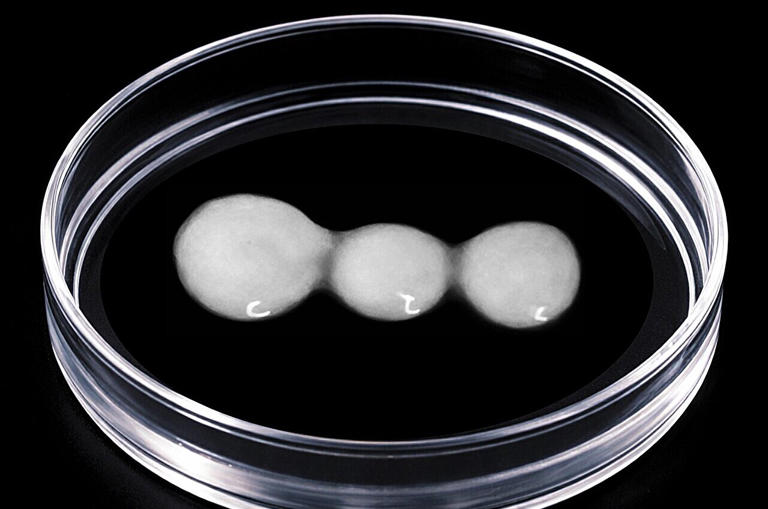 Lab-grown brain-spinal cord model shows 'irreversible' nerve damage may ...