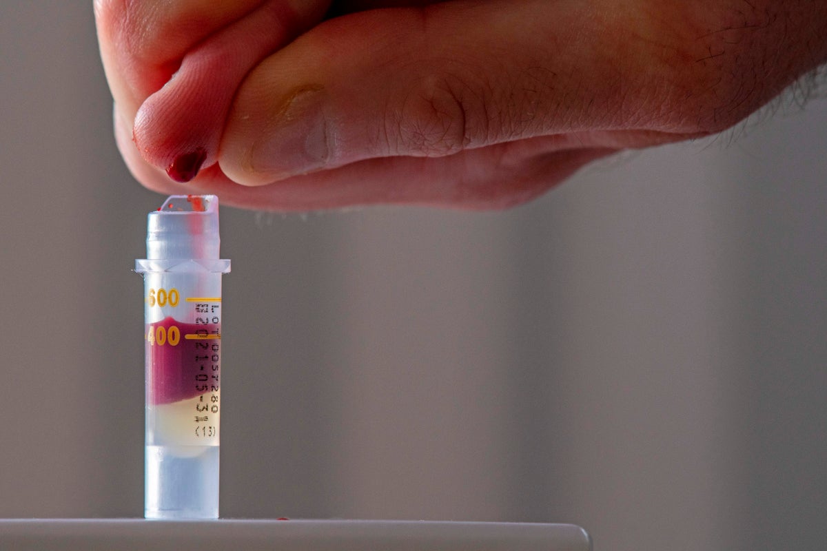 How a simple blood test could spot signs of Alzheimer’s early