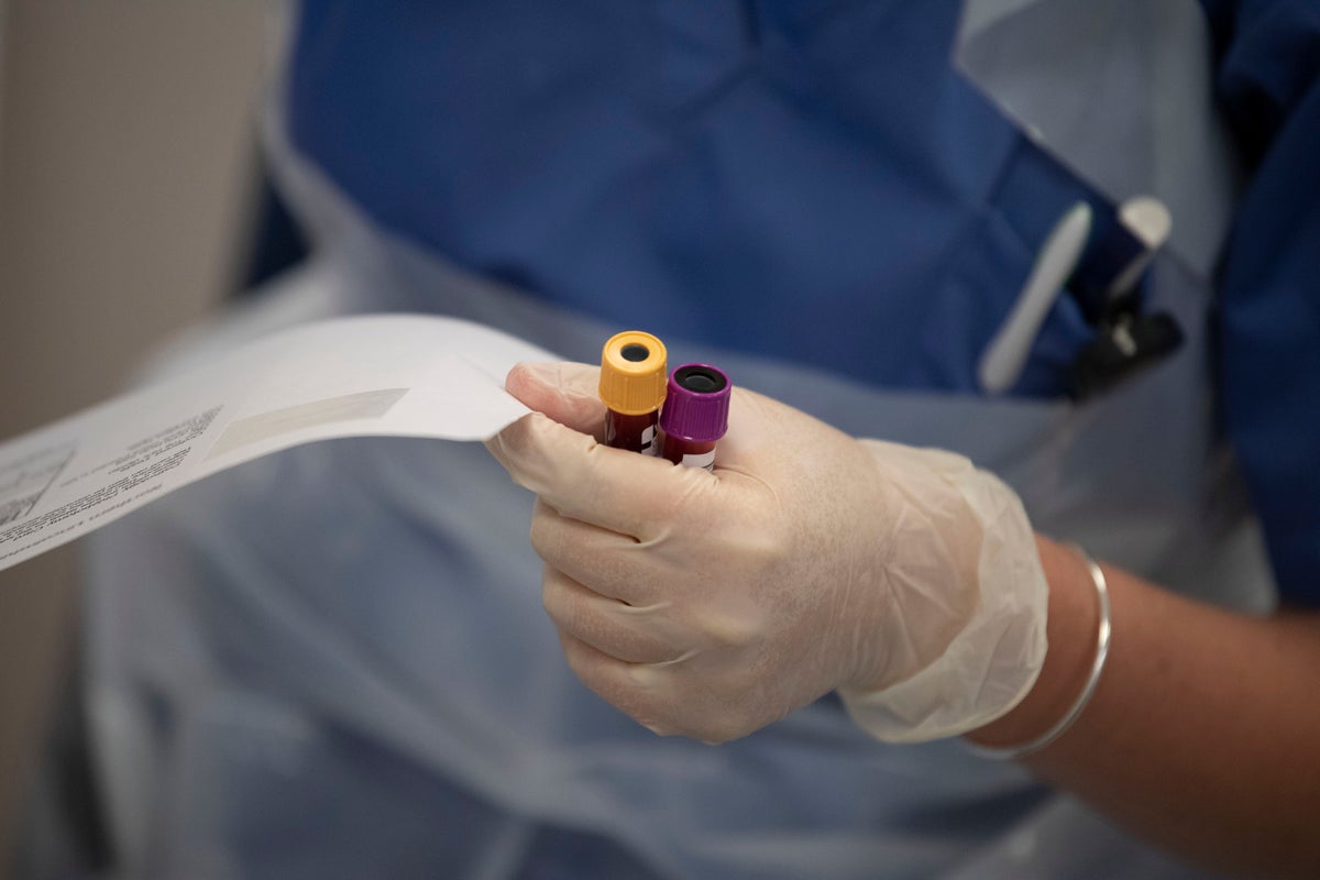 Blood test could detect signs of Alzheimer’s decades before symptoms ...