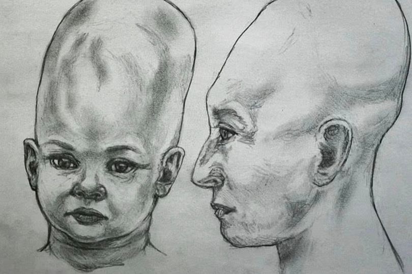 'Conehead humans' could be aliens as DNA tests leave scientists baffled