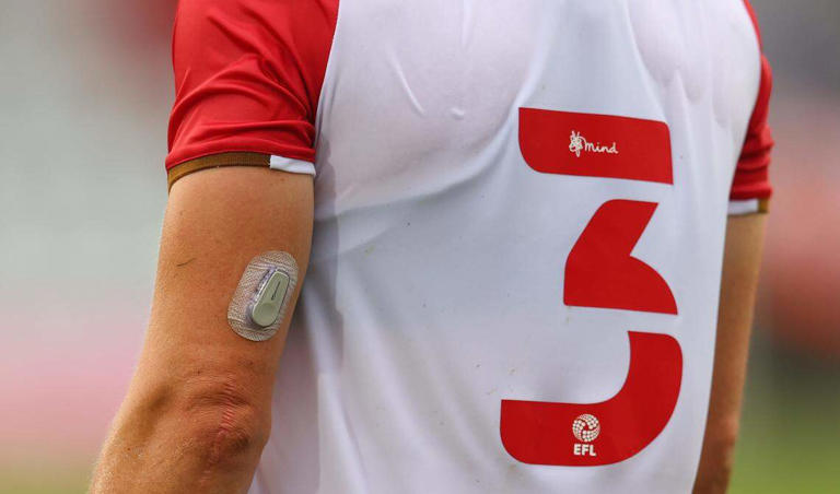CGM application, placement and adhesion troubleshooting to make sure ...