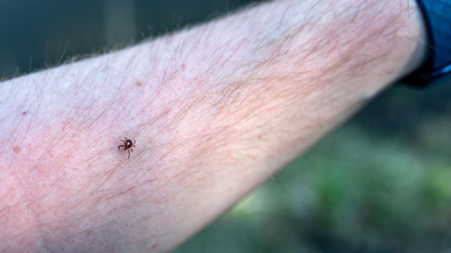 Simple backyard tick bite could make you allergic to meat for life ...