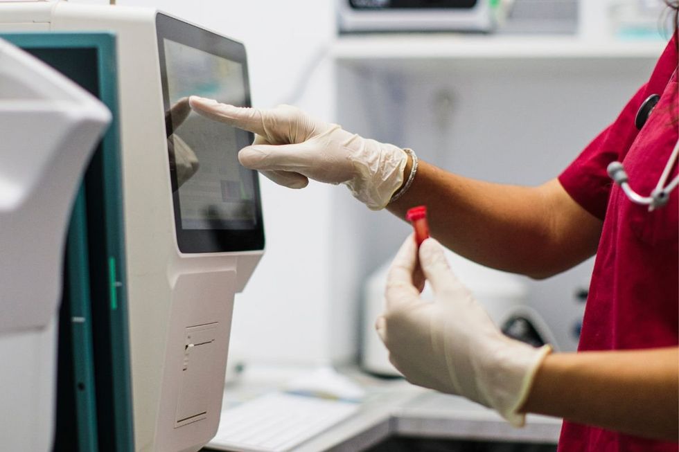 Simple blood test could reveal Alzheimer's decades before symptoms appear