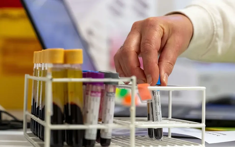 Blood test shows promise for detecting Alzheimer’s decades early