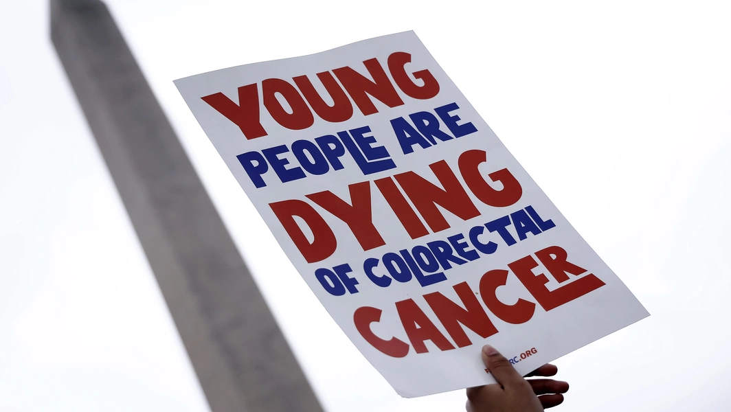 Colon cancer truths everyone should know now