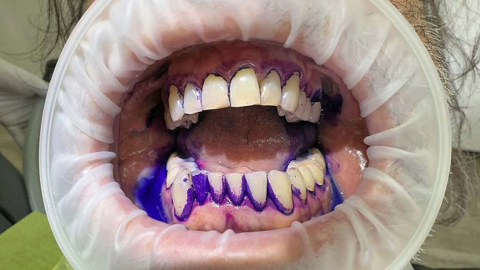 Floss smarter for a healthier smile