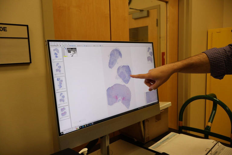Inside the fight against 'zombie deer disease,' scientists confront ...