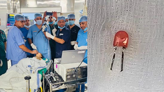 LED bulb lodged in lung removed, Indian Army doctors save 9-month-old
