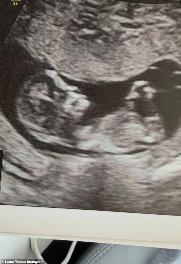 Laura Woods announces she is expecting her second child with fiancé ...