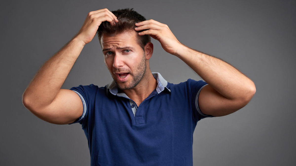 Receding hairline vs balding: How to tell the difference