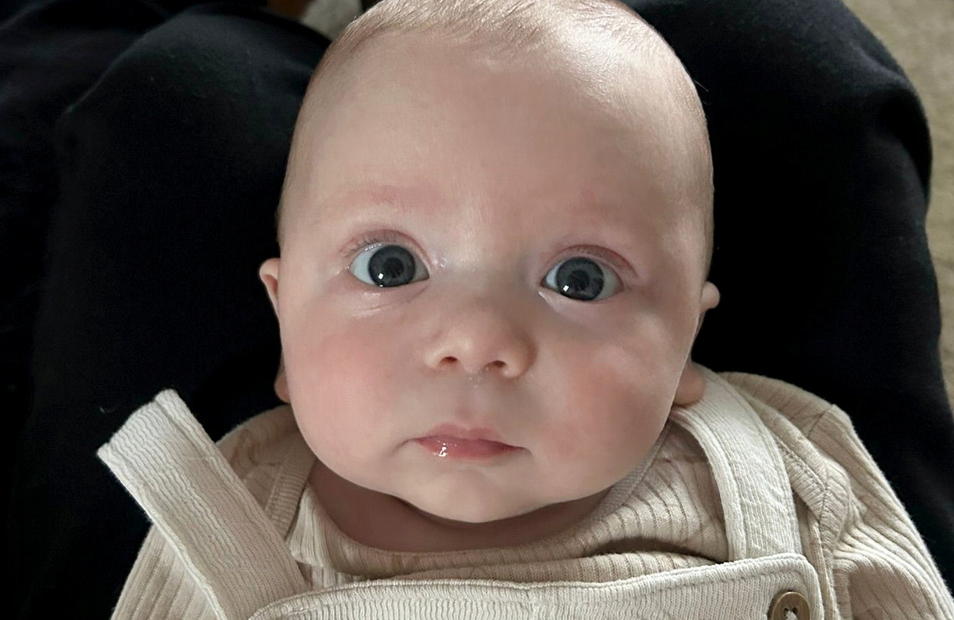 My baby stopped smiling and it was a hidden sign of a rare disease
