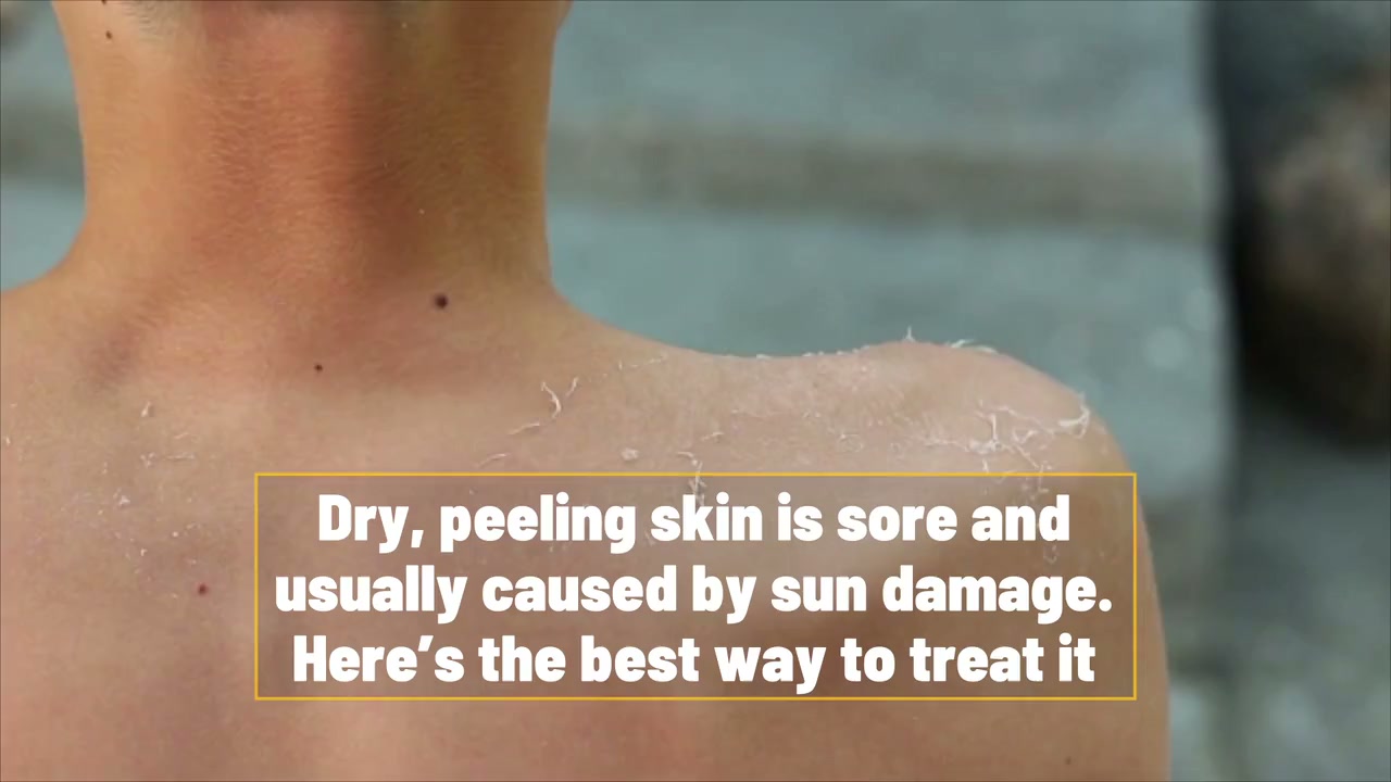 Here's how to treat and stop peeling skin