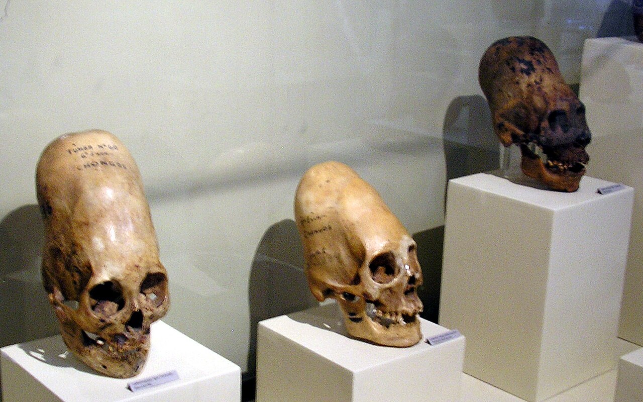 Are the Peru conehead mummies aliens? Paranormal expert claims skulls ...