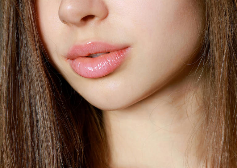 Hyaluronic acid for lips: Why hydration may change everything