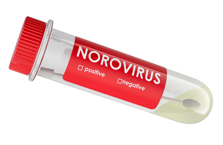 Highly contagious vomiting bug spreading across the US.: Report