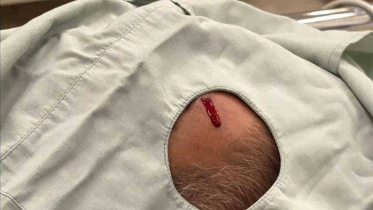 Un chauffeur de taxi blessé au visage par un pistolet à plomb réclame ...