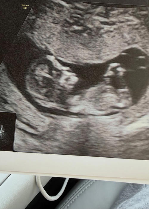 Adam Collard and fiancée Laura Woods announce their family is growing