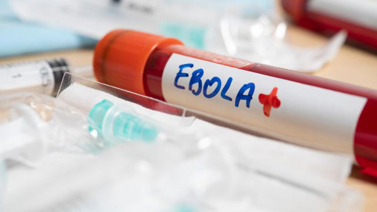 Ébola (virus Bundibugyo) qué es y por qué preocupa antes del Mundial 2026