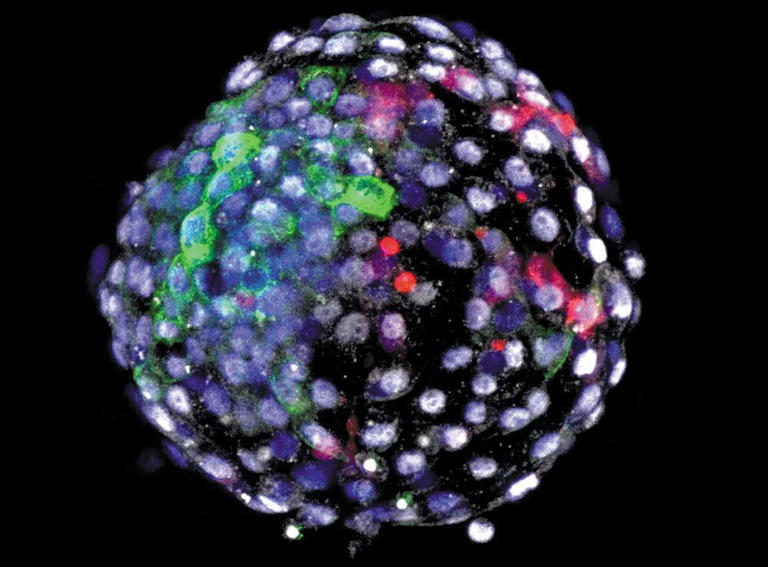 Human chimeras challenge DNA evidence in court cases