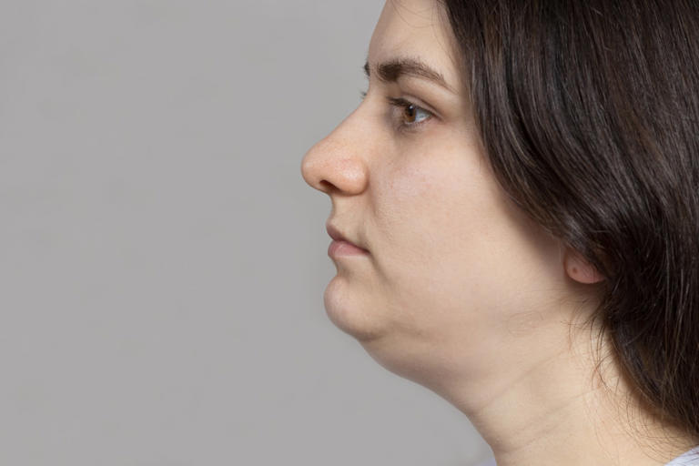 2 easy exercises for a sagging neck