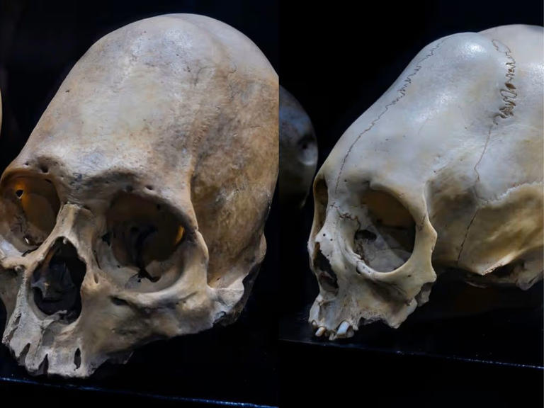 Peru's conehead mummies: Why do DNA tests still fail to solve 'human or ...