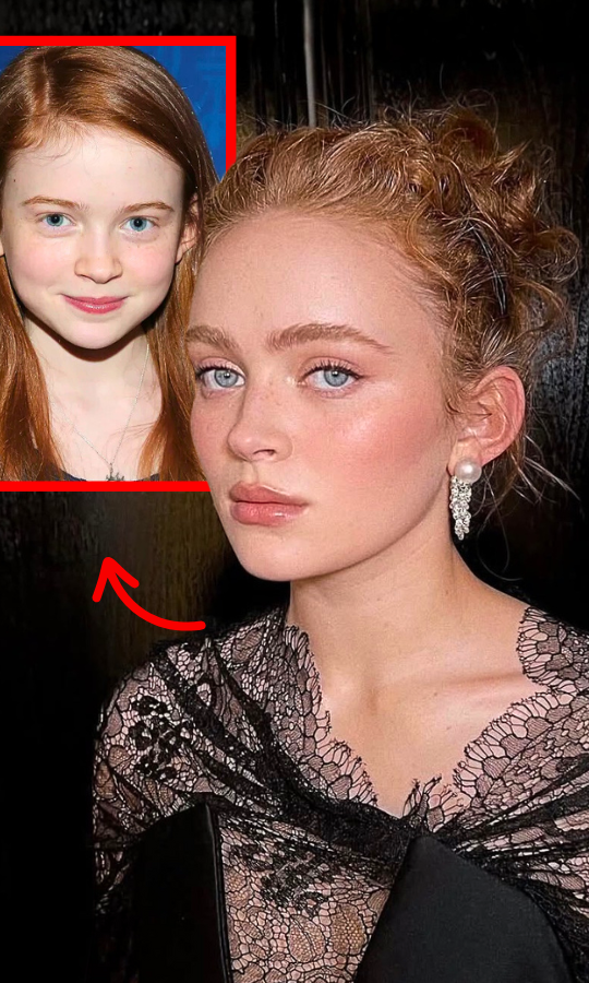 Stranger Things star Sadie Sink on cosmetic surgery 🚨