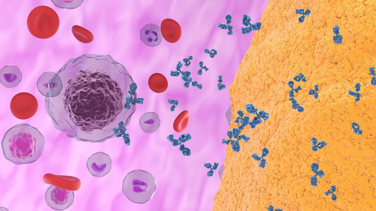 Serology affects transition from arthralgia to full-blown rheumatoid ...