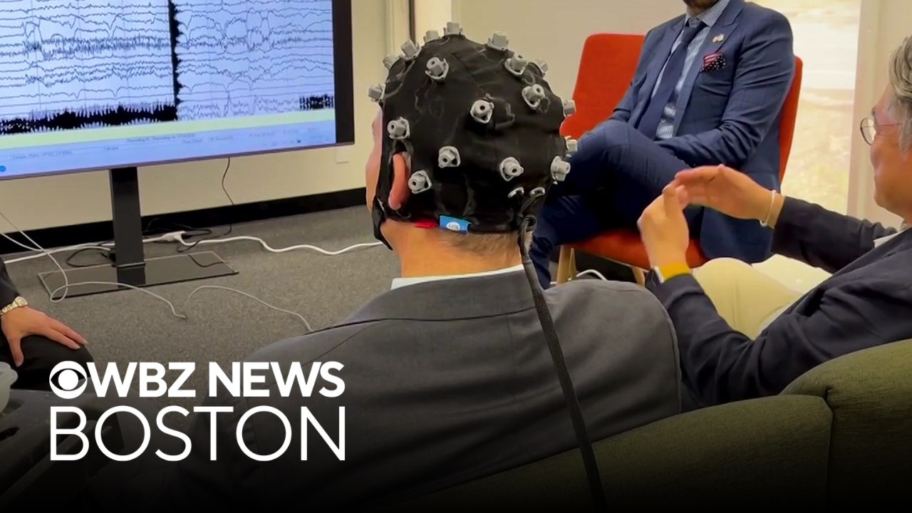 Stanford neurologist maps the brain to visualize signal flows