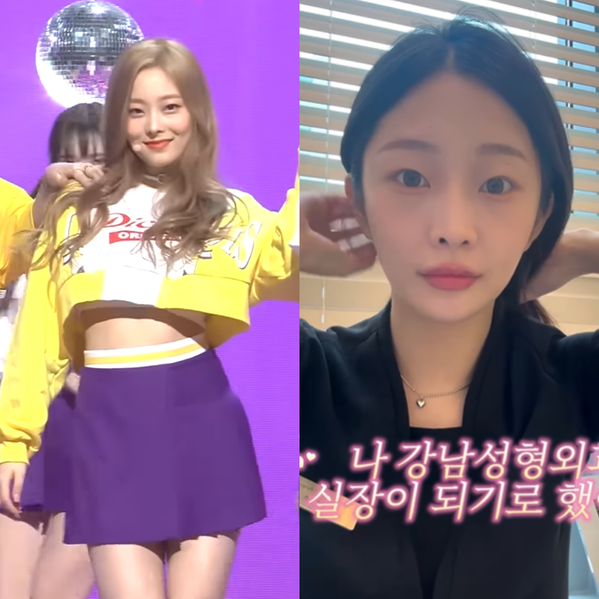 Eunwoo of Pristin becomes a plastic surgery clinic manager “I envy IOI ...