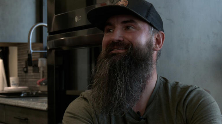 Jaiden Bauer shares journey to recovery after being seriously burned in ...