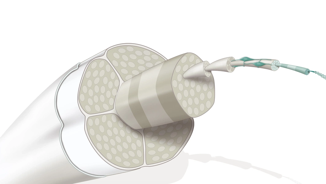 New hope for stubborn tendon pain relief
