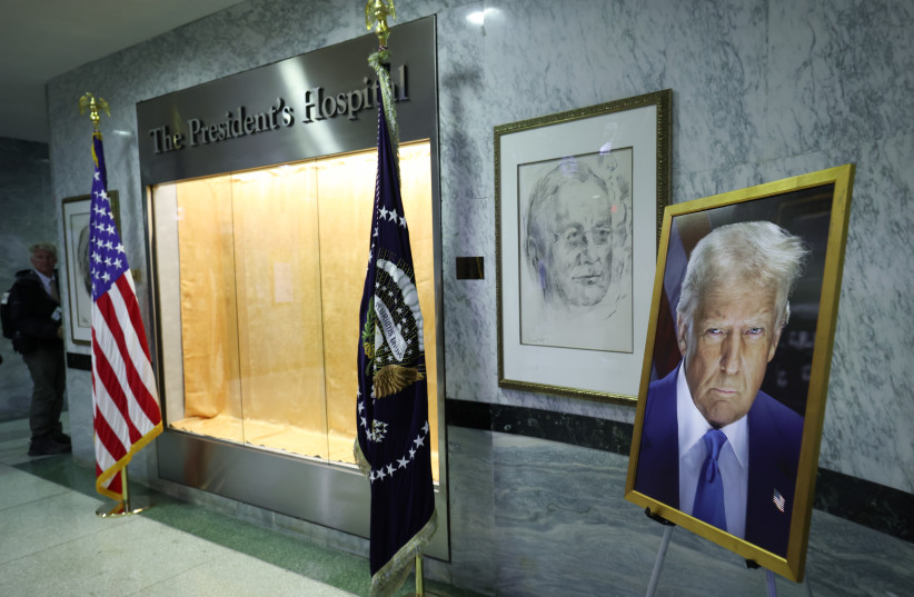 Trump in excellent health with leg swelling, hand bruising, doctor says