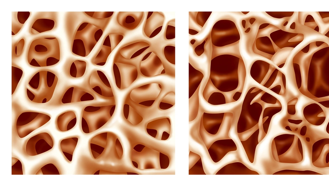 Scientists probe GLP-1 drugs’ brain effects and bone risks