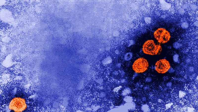 Researchers make progress towards 'functional cure' for chronic hepatitis B